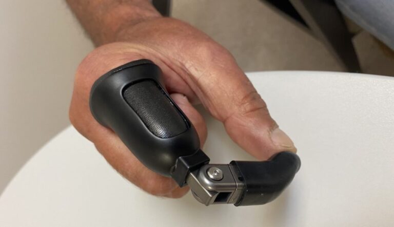 Partial Hand Solutions 3D-Drucke von Finger- und Handprothesen mit ...