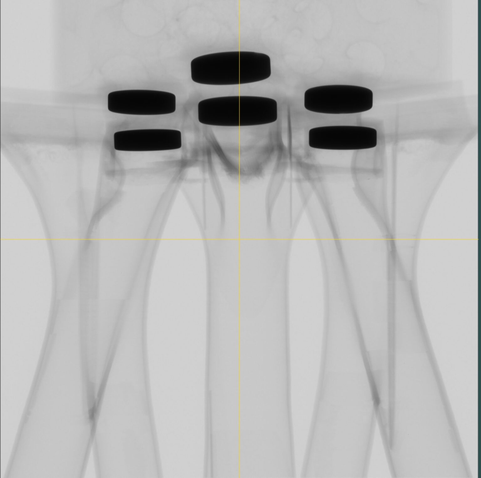 Bessel Creates Medical Devices With Autodesk Fusion - Fusion Blog